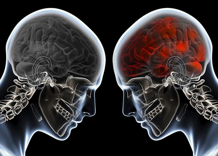 Retour du MOOC sur les commotions cérébrales